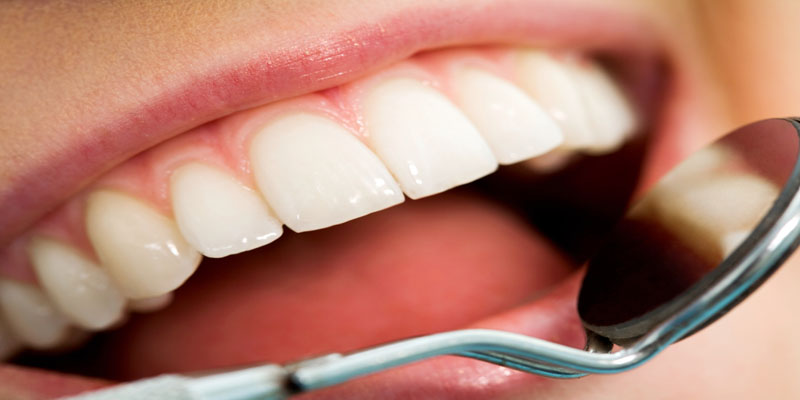 Teeth-in-an-hour at PERFECT SMILE Dental Clinic